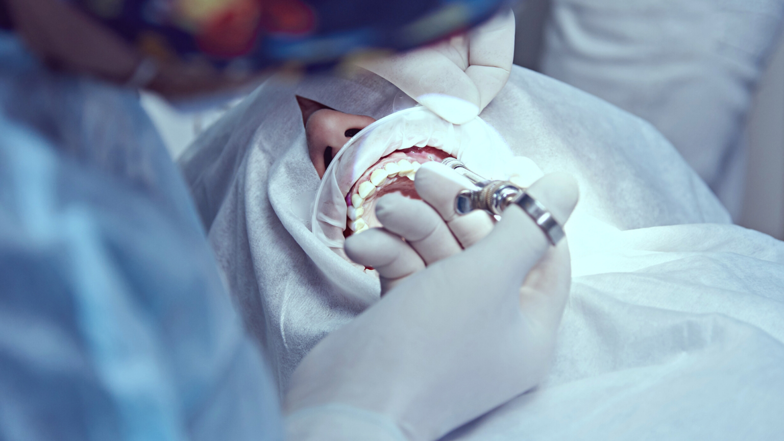 Stomatochirurgie - TopDent